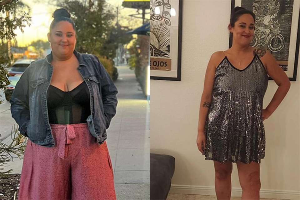 Vanessa's Story - Gastric Sleeve, VSG (Vertical Sleeve Gastrectomy ...