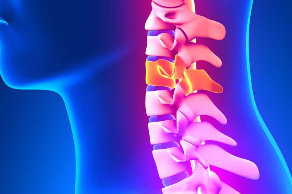 Cervical surgery relieves mystery itch | UCLA Health