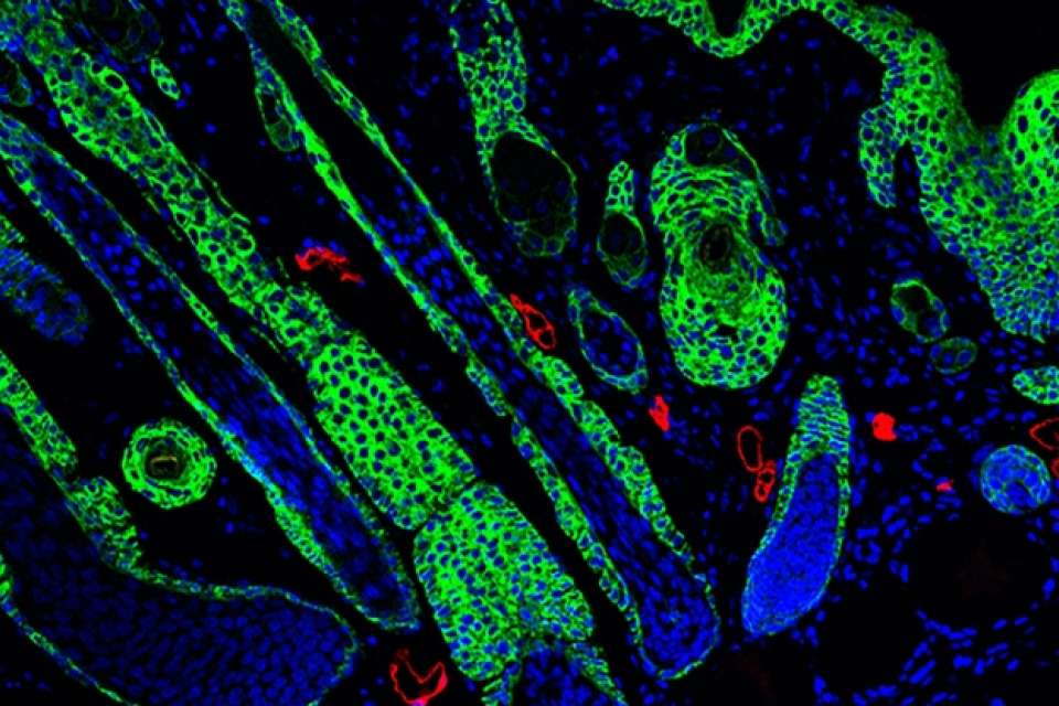 New Wound-Healing Biomaterials Reduce Scarring and Promote Tissue ...