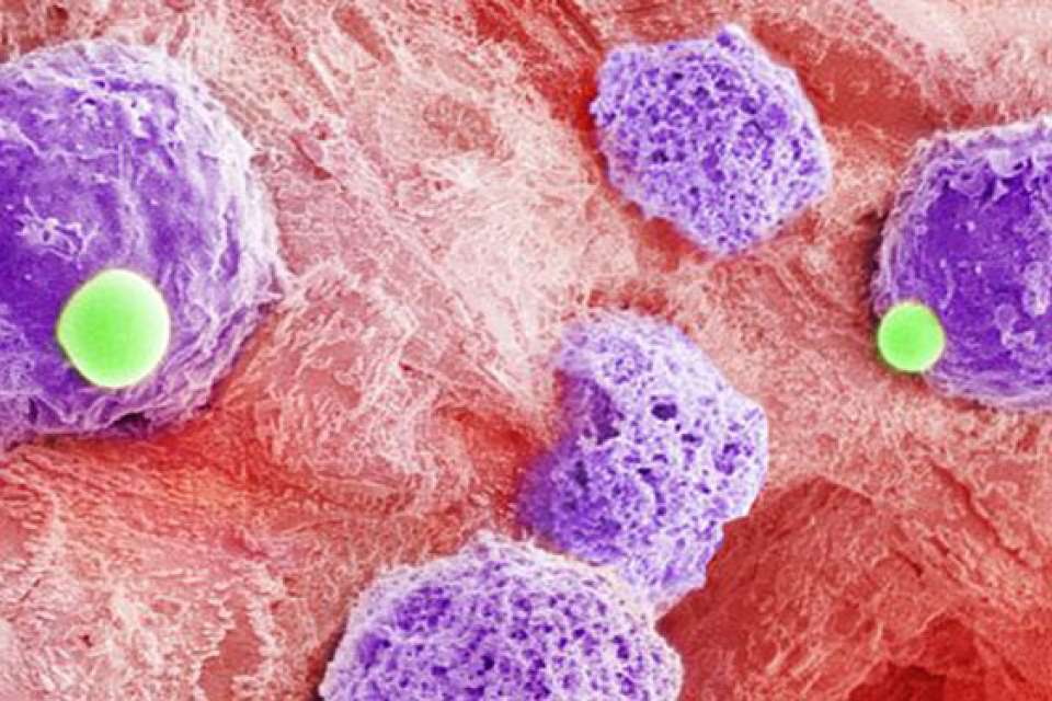 Method makes it easier to separate useful stem cells from 'problem ...