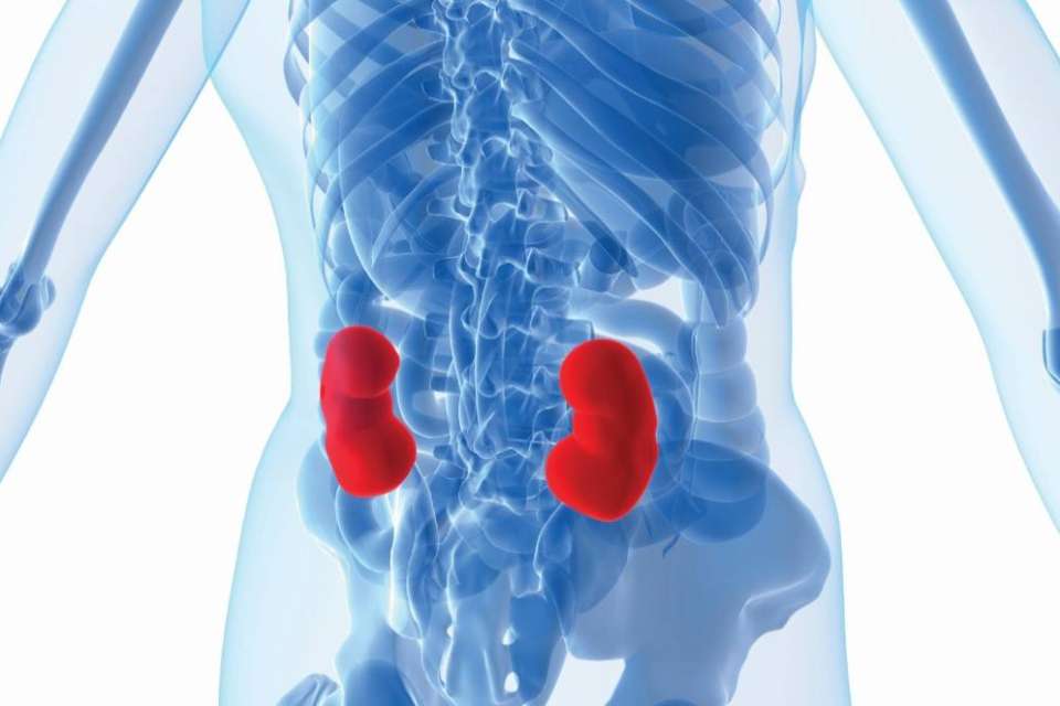 High creatinine levels can indicate chronic kidney disease | UCLA Health