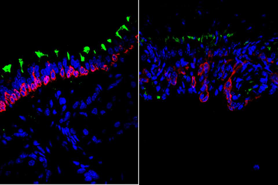 How airway cells work together in regeneration and aging | UCLA Health