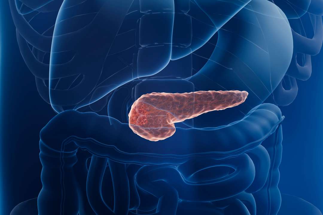 Immunotherapy plus chemotherapy before surgery shows promise for ...