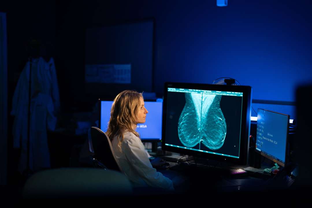 UCLA to lead $16 million national study on artificial intelligence in breast cancer screening ...