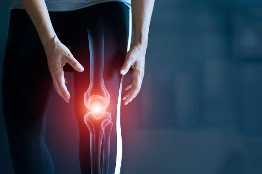 The sprint to an osteoarthritis cure has begun | UCLA Health