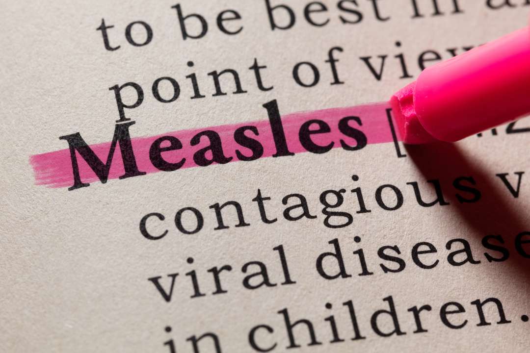 Measles Infection Can Cause Immune Amnesia | UCLA Health