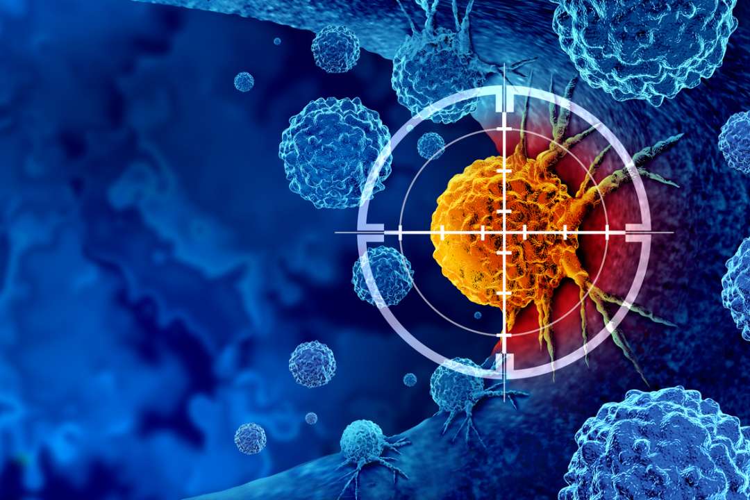 Targeted therapy drug shows early promise against KRAS-driven lung and ...