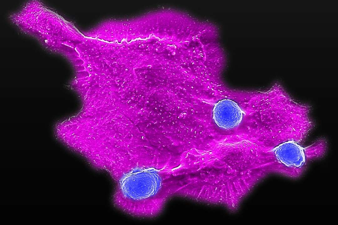 UCLA scientists develop one-product-fits-all immunotherapy for breast ...