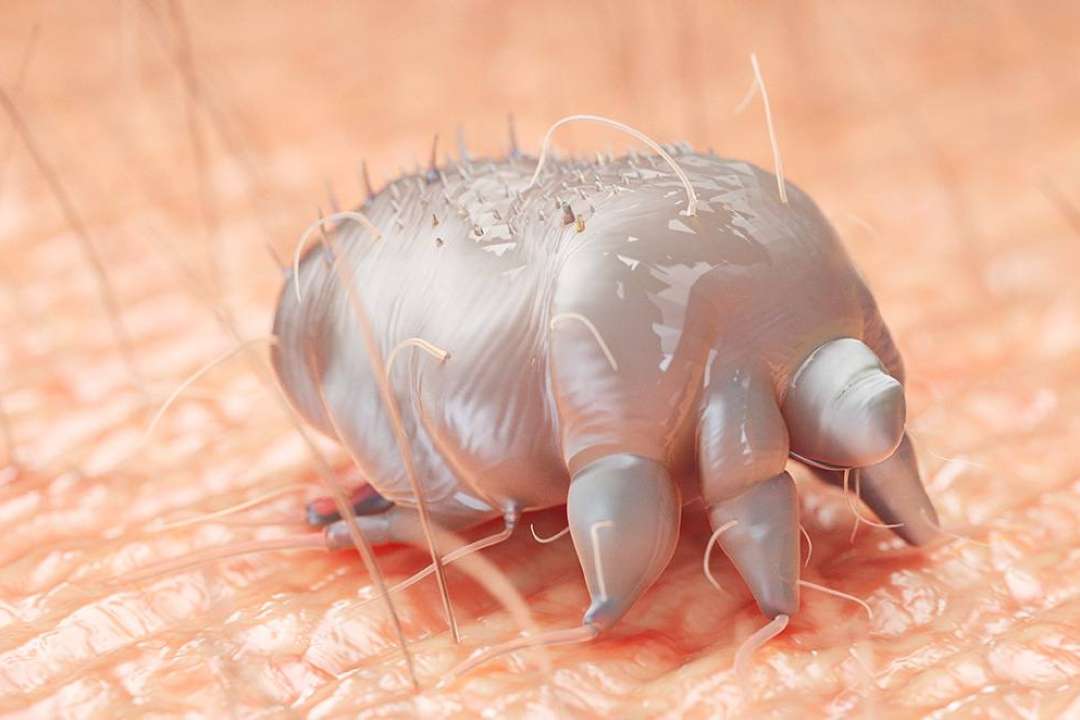 Scabies burrow into skin, cause extreme itch | UCLA Health