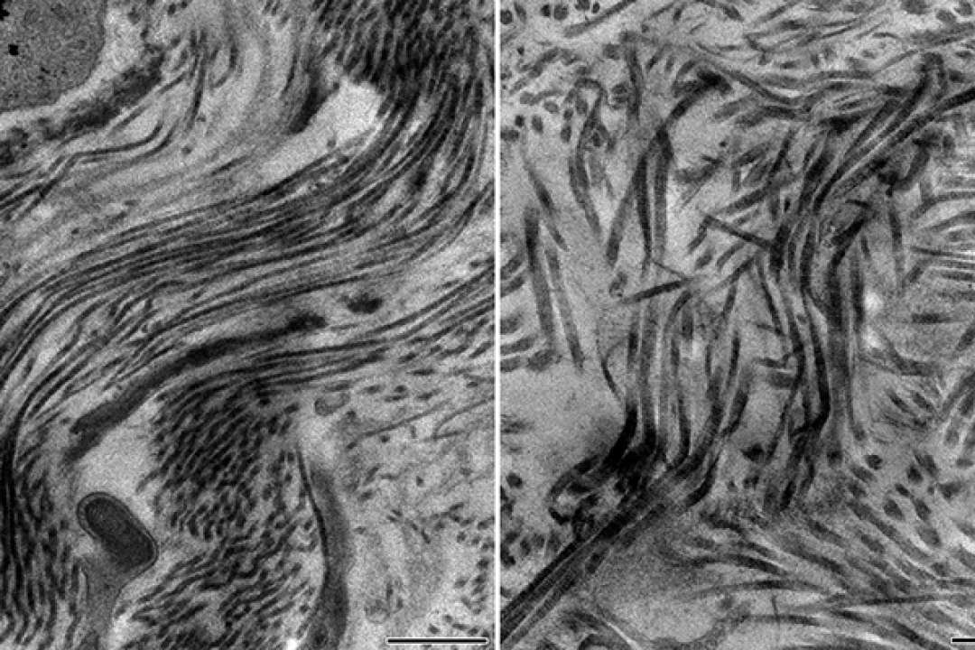 How the body regulates scar tissue growth after heart attacks | UCLA Health