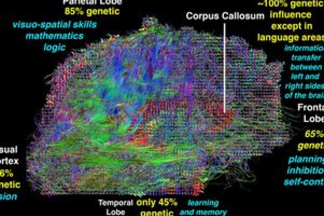 Study gives more proof that intelligence is largely inherited | UCLA Health