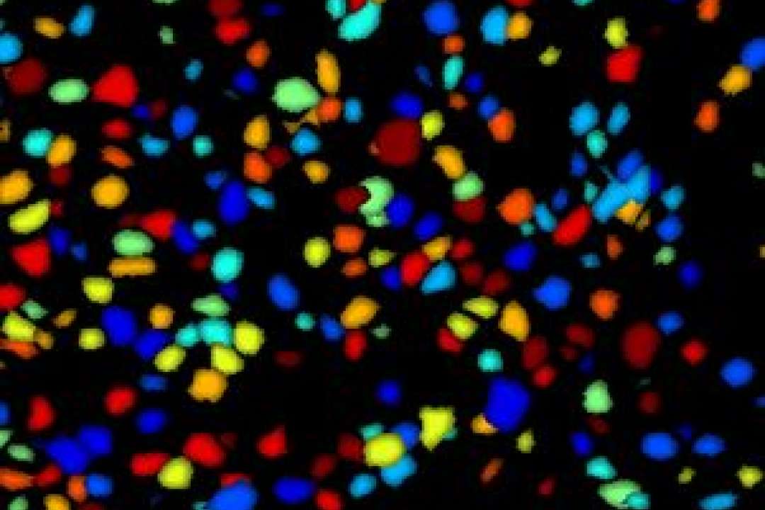 UCLA scientists receive prestigious BRAIN Initiative grant from NIH ...