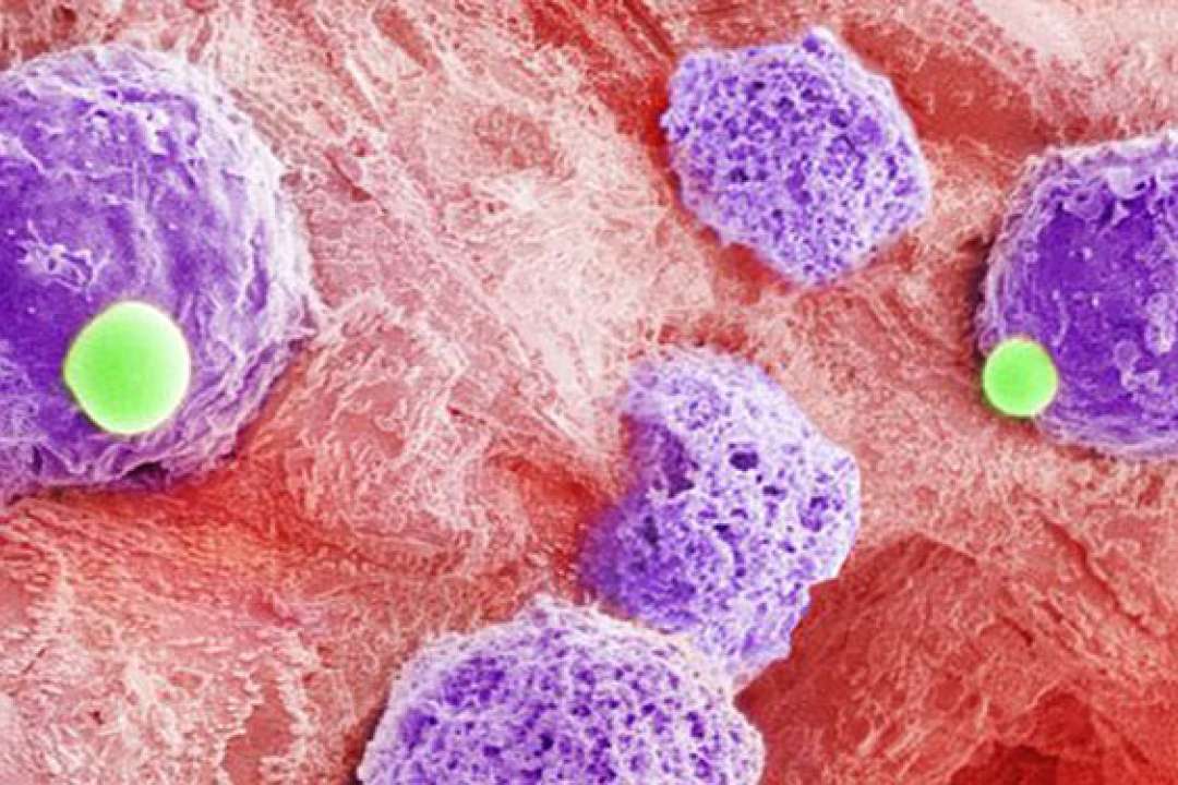 Method makes it easier to separate useful stem cells from 'problem ...