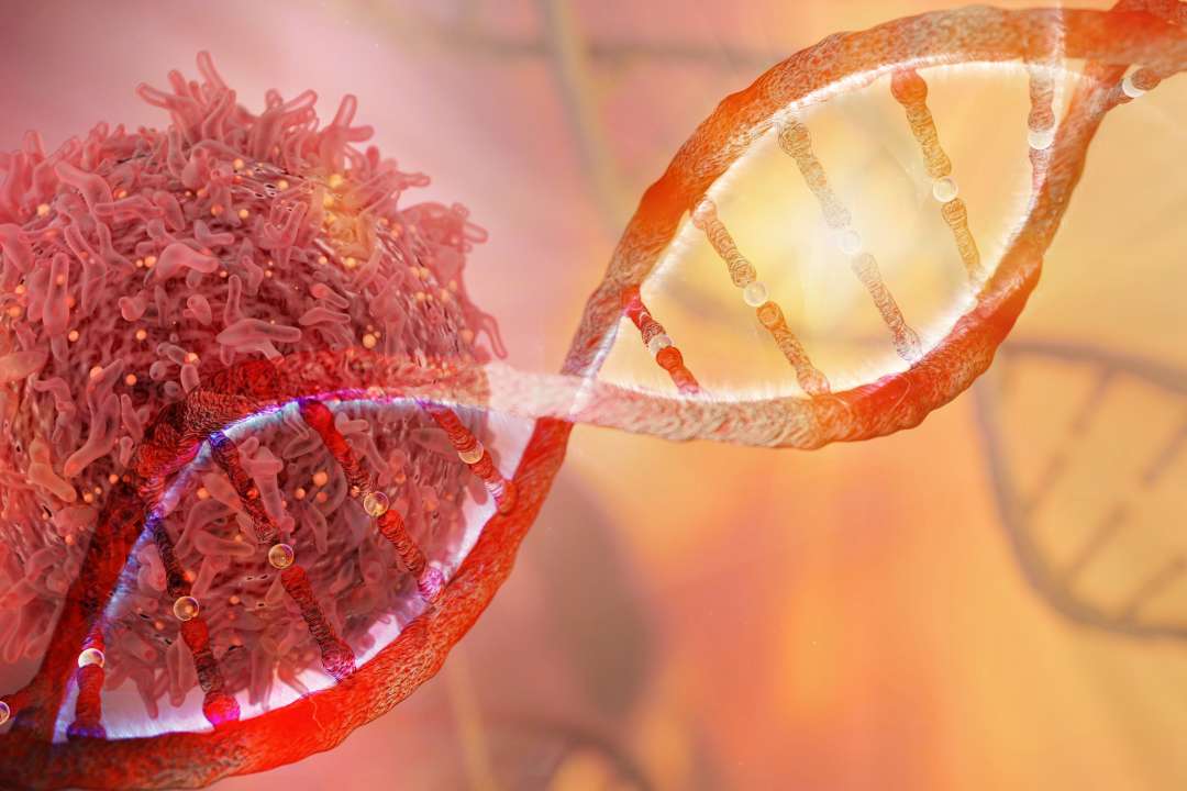 Study uncovers genetic drivers of aggressive prostate cancer | UCLA Health