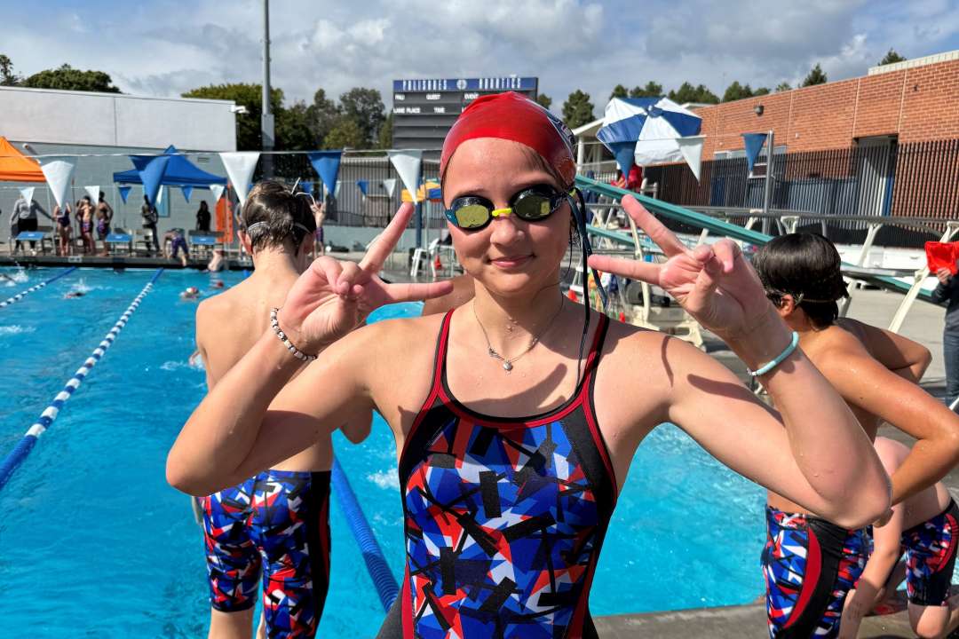 The fix for pectus excavatum, or ‘sunken chest syndrome’ | UCLA Health