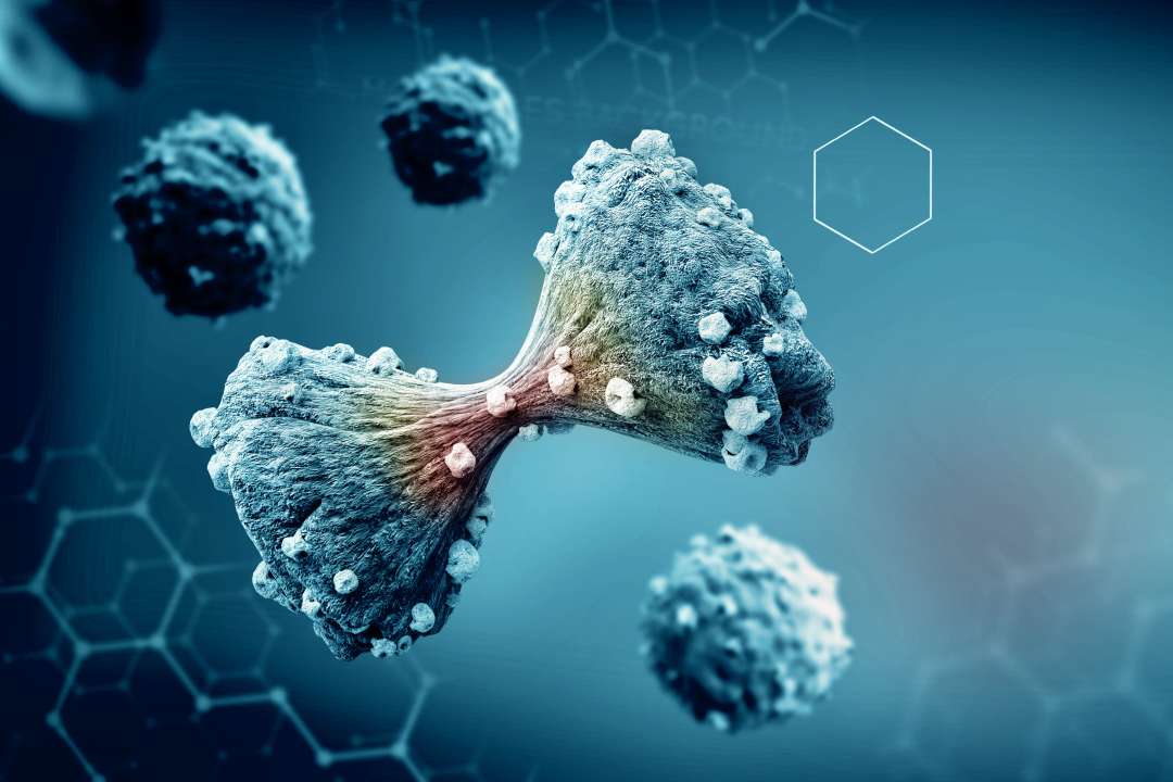 Theranostics treatments for cancer underway at UCLA Health - Cancer ...