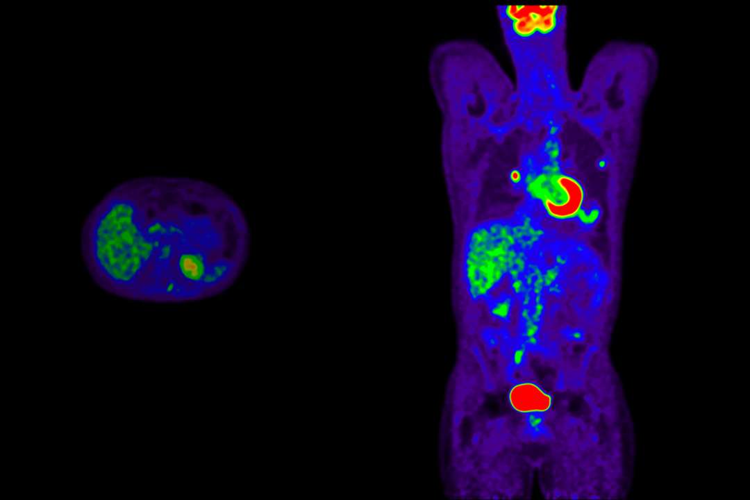UCLA Health launches Department of Nuclear Medicine and Theranostics ...