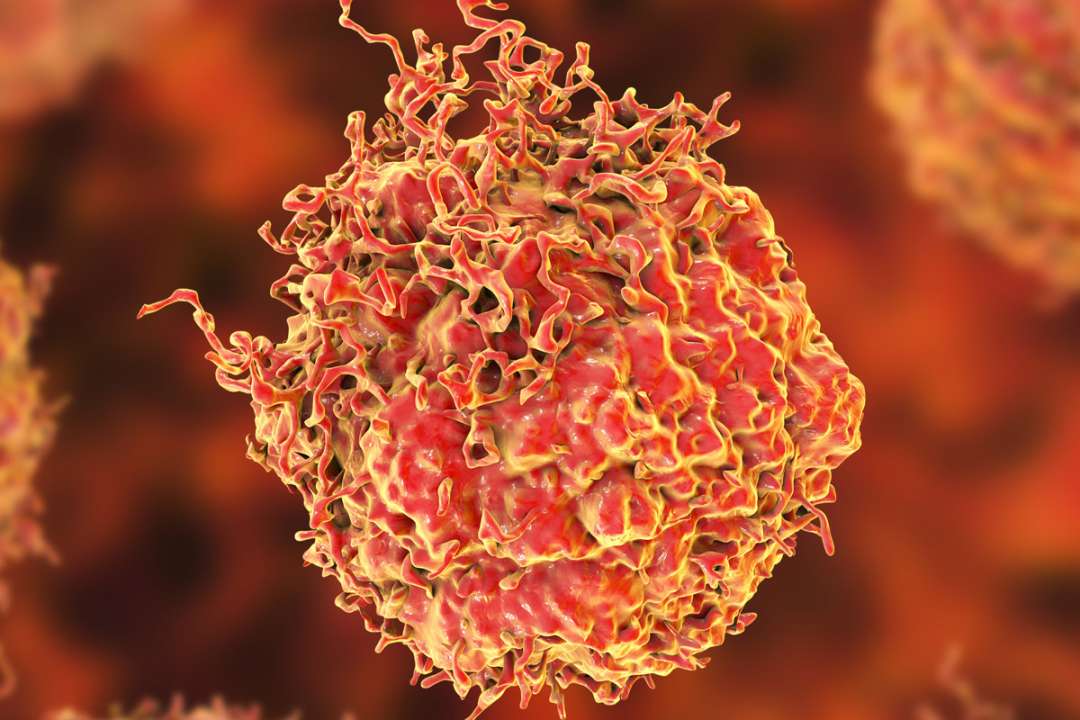 For prostate cancer, PSMA imaging helps diagnosis, staging and ...