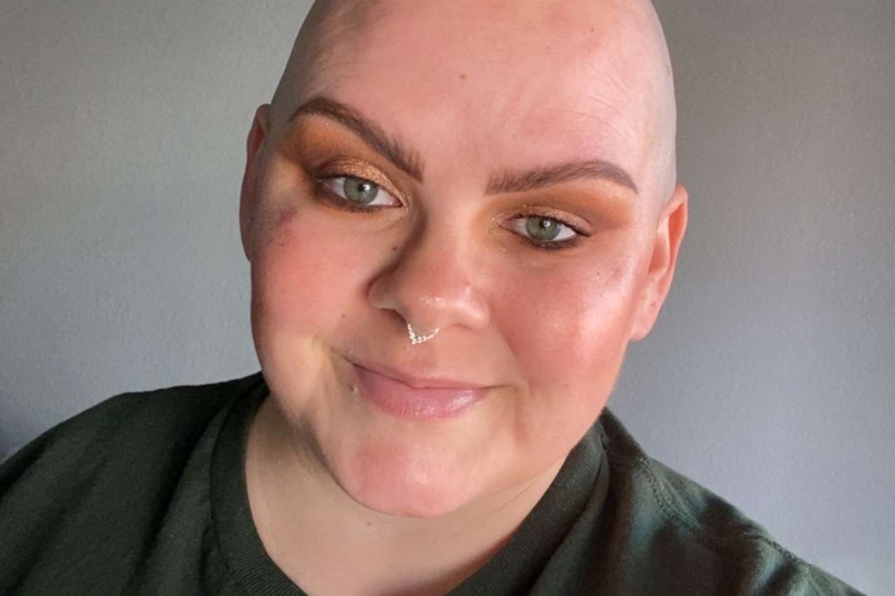 Support for a young generation of patients with cancer | Simms Mann ...