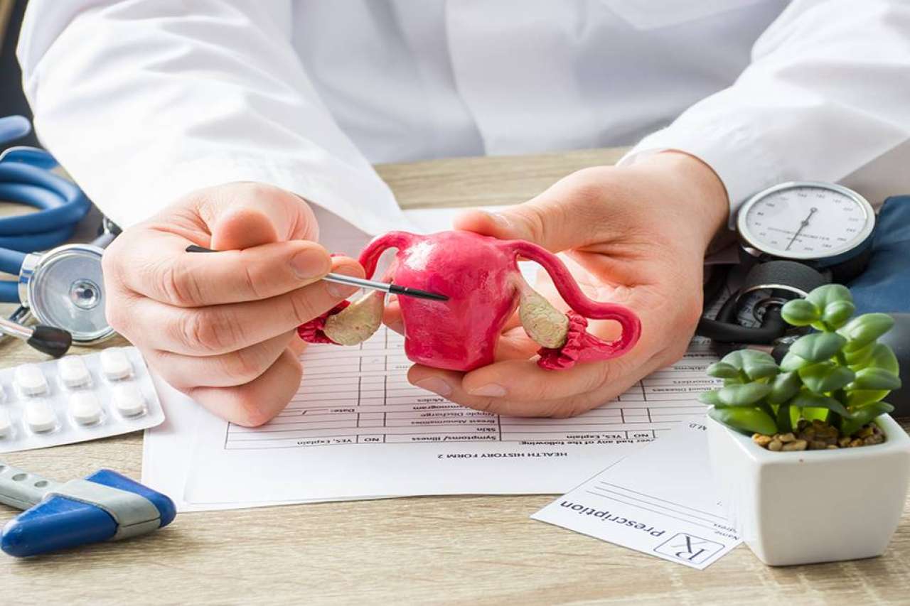 Gynecologic cancers: Know the symptoms and how to reduce your risk ...