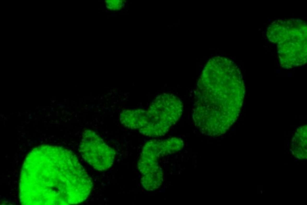 Stem cell discovery may help conquer pediatric germ cell tumors | UCLA ...