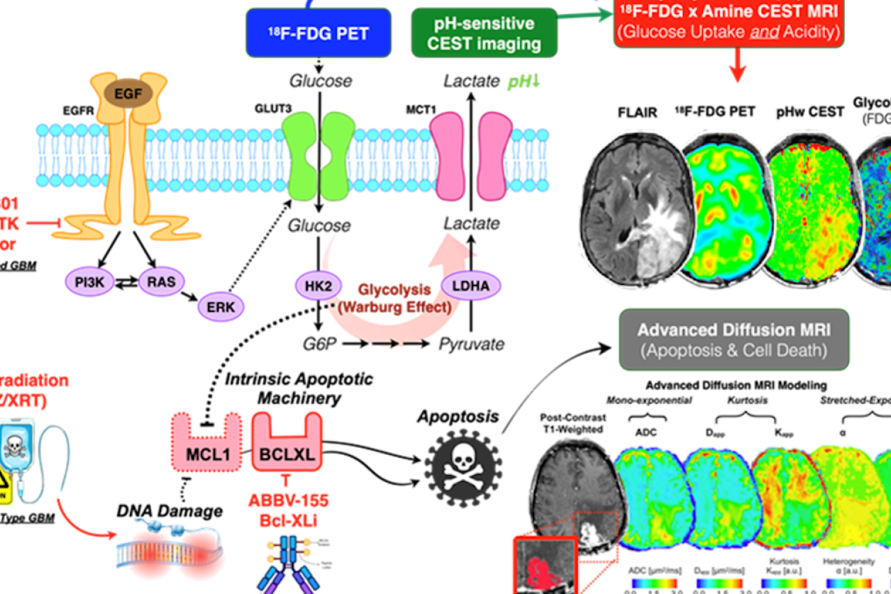 Taking brain cancer science from discovery to novel clinical trials ...