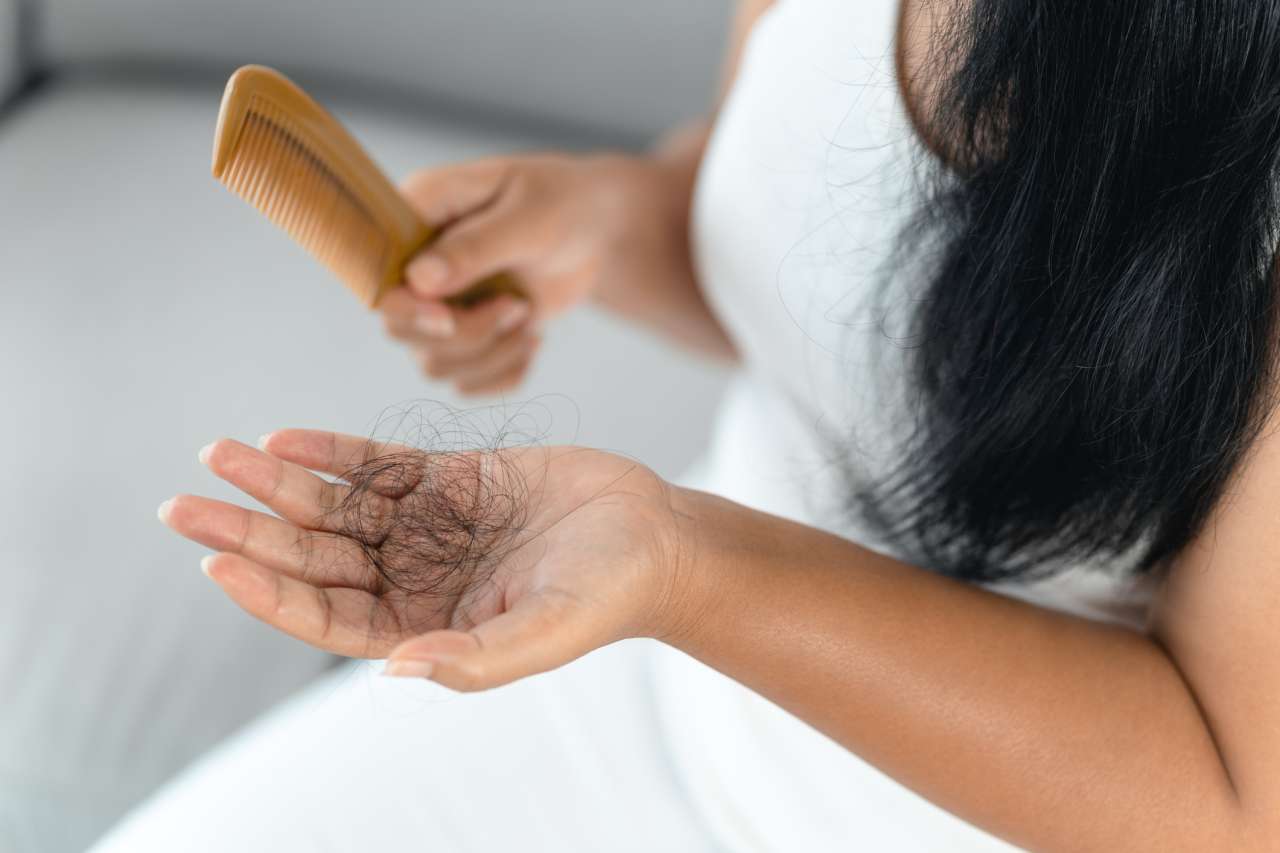 What causes female hair loss? | UCLA Health