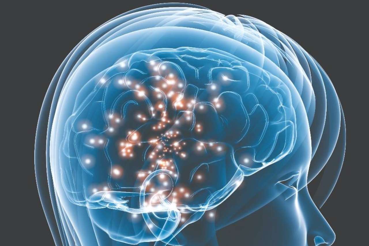 Loss of speech after stroke is called aphasia | UCLA Health