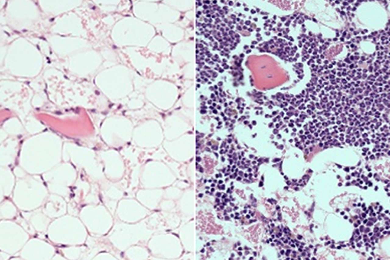 Drug accelerates blood system’s recovery after chemotherapy, radiation ...