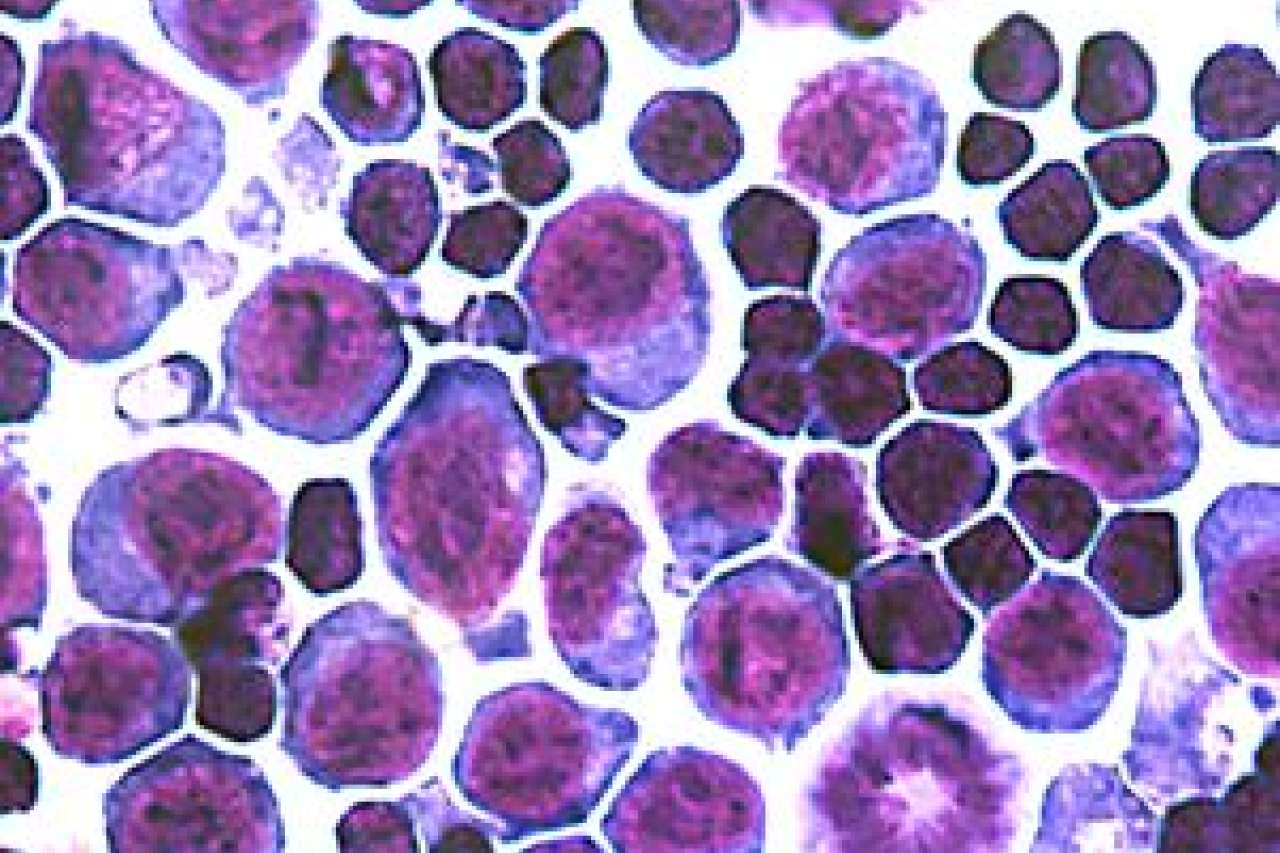 Researchers discover hormone that controls supply of iron in red blood ...