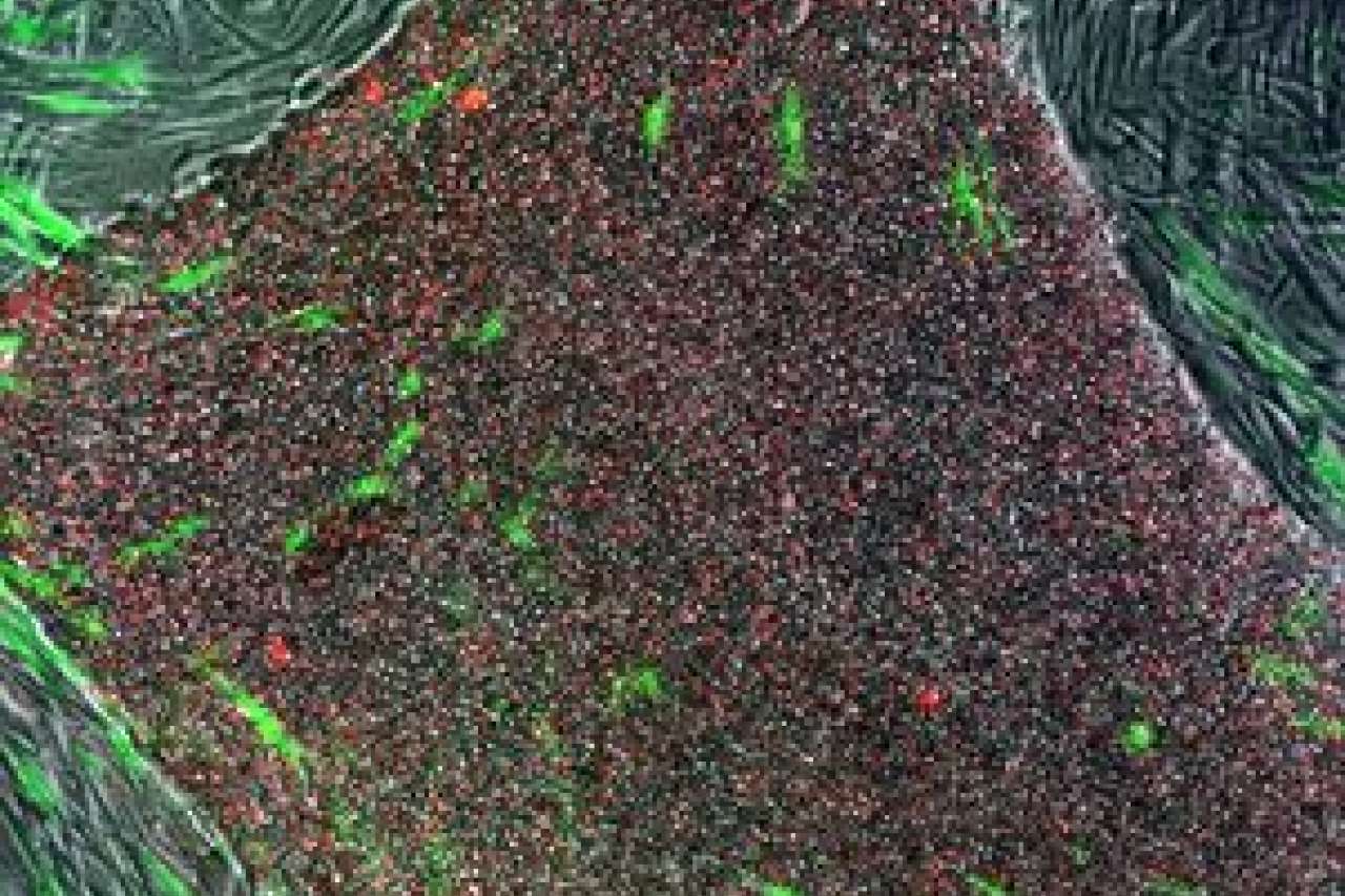 UCLA researchers issued patent for method that helps validate stem ...