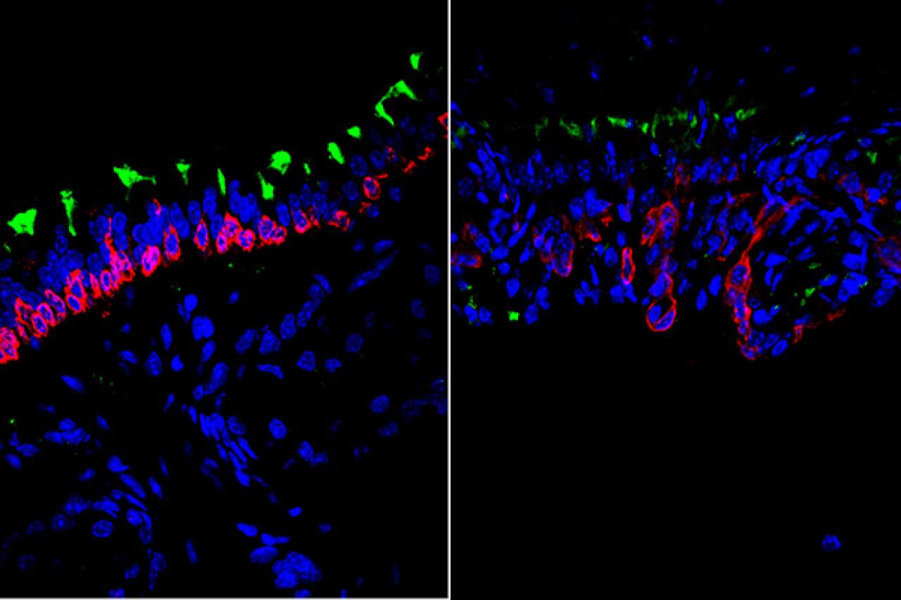 How airway cells work together in regeneration and aging | UCLA Health