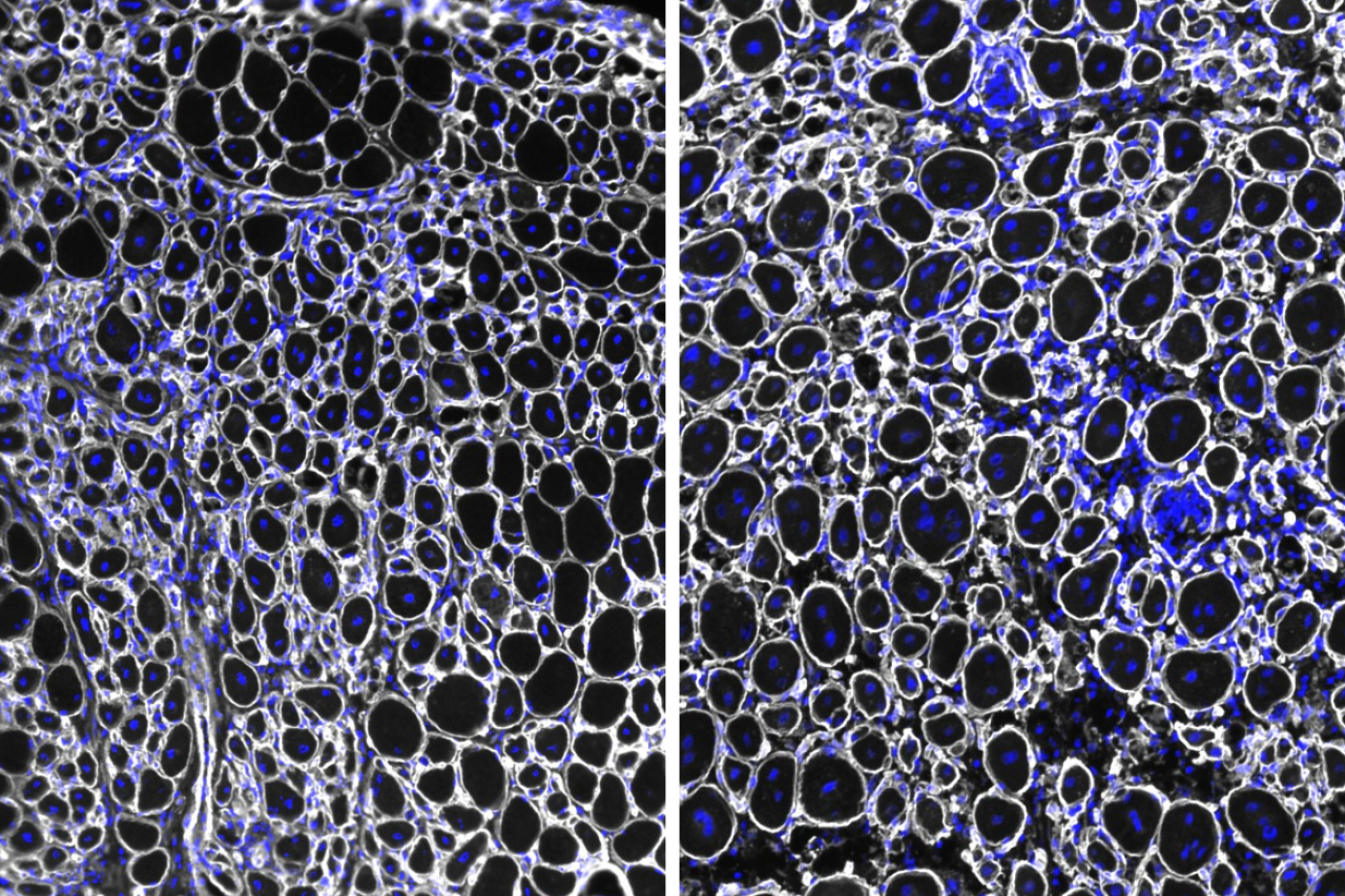 Muscle stem cells build resilience but lose regenerative power with age ...