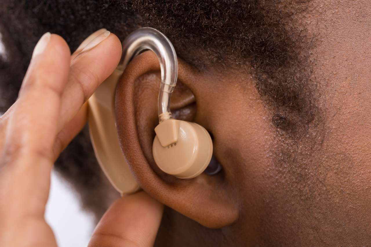 SNHL most common category of hearing loss | UCLA Health