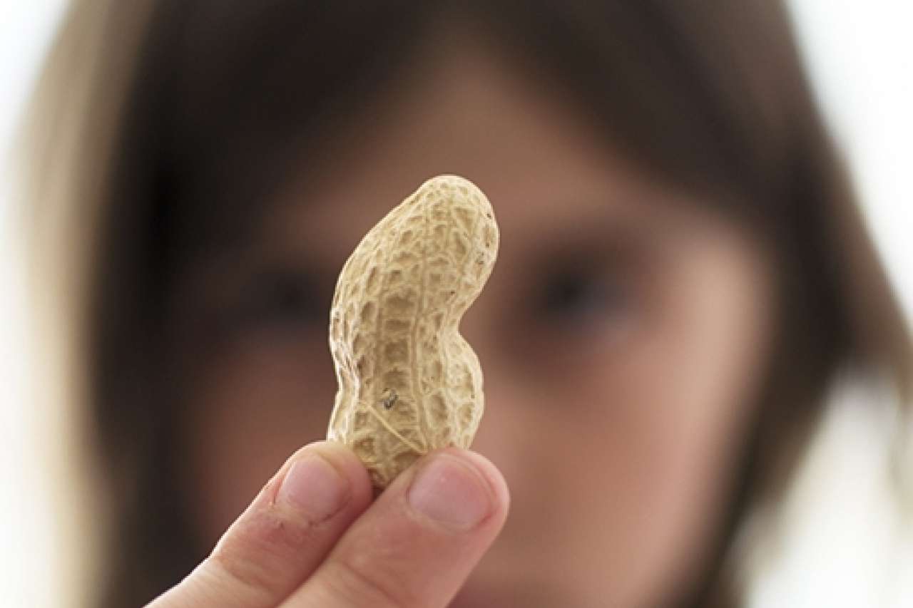 How to prevent peanut allergy in infants | UCLA Health