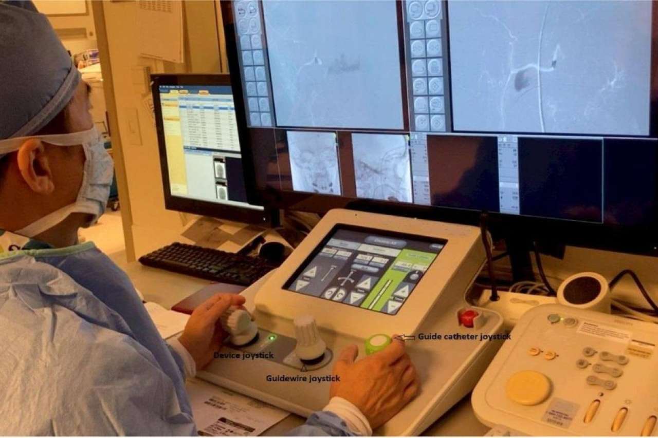 For many stroke patients, robotic thrombectomy speeds treatment and ...