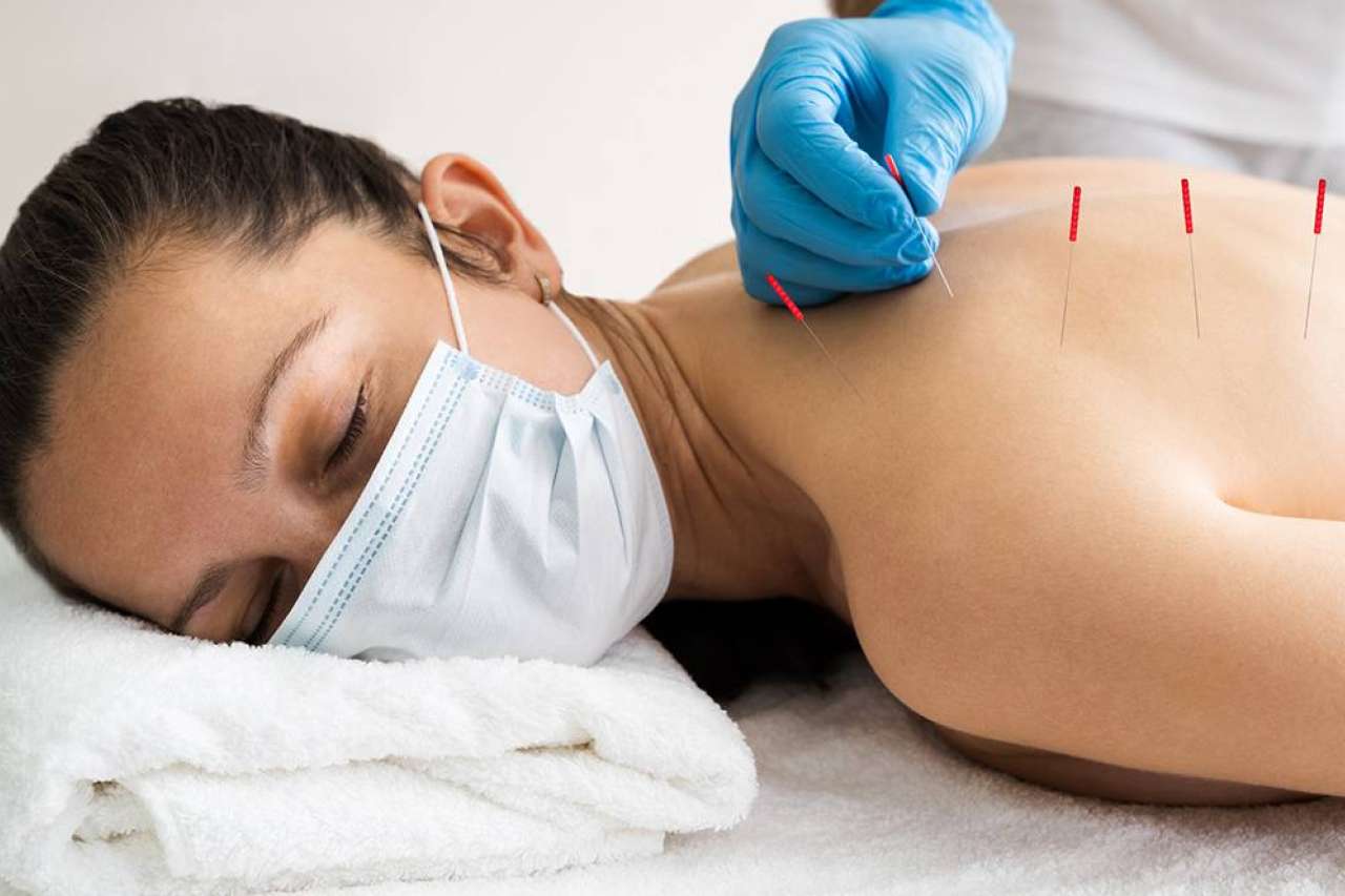 The benefits of acupuncture for cancer patients and survivors | UCLA Health