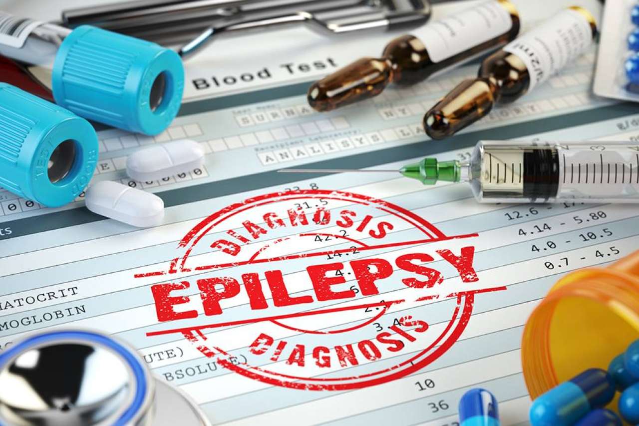 Options for drug-resistant (refractory) epilepsy | UCLA Health