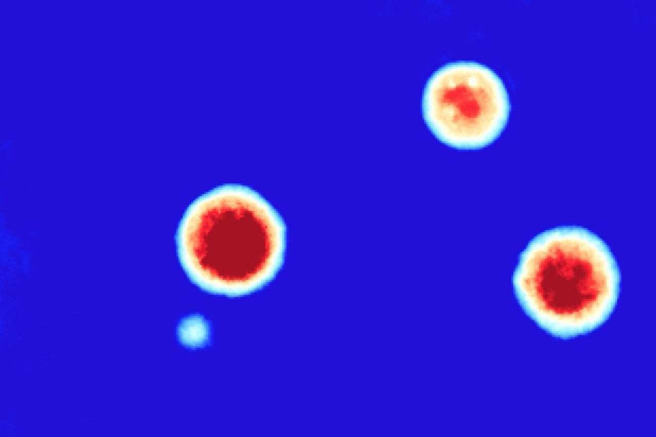Fine-tuning 3D lab-grown mini tumors to help predict how patients ...