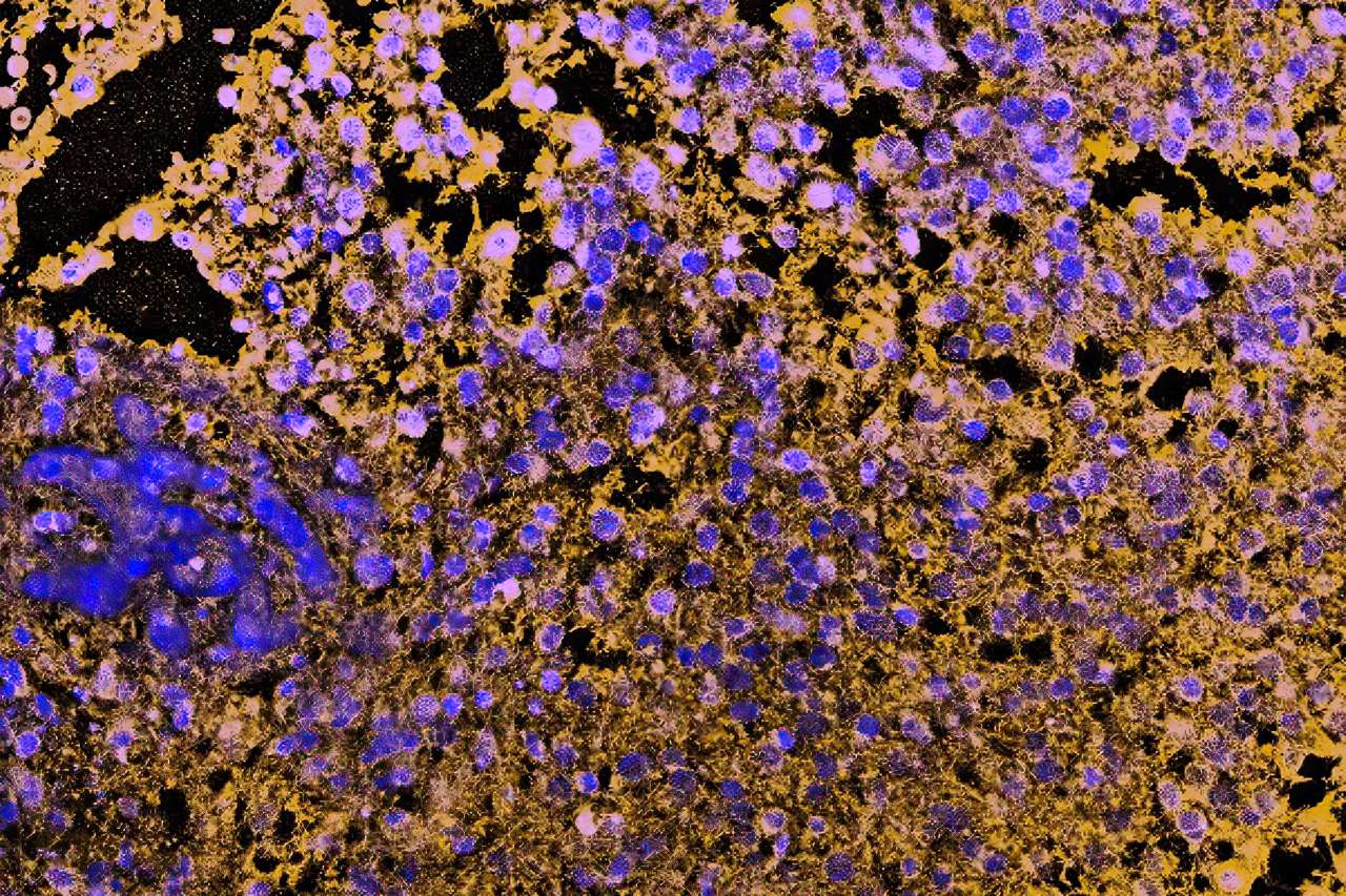 Steven Bensinger, VMD, PhD - Member Directory | UCLA Health Jonsson ...