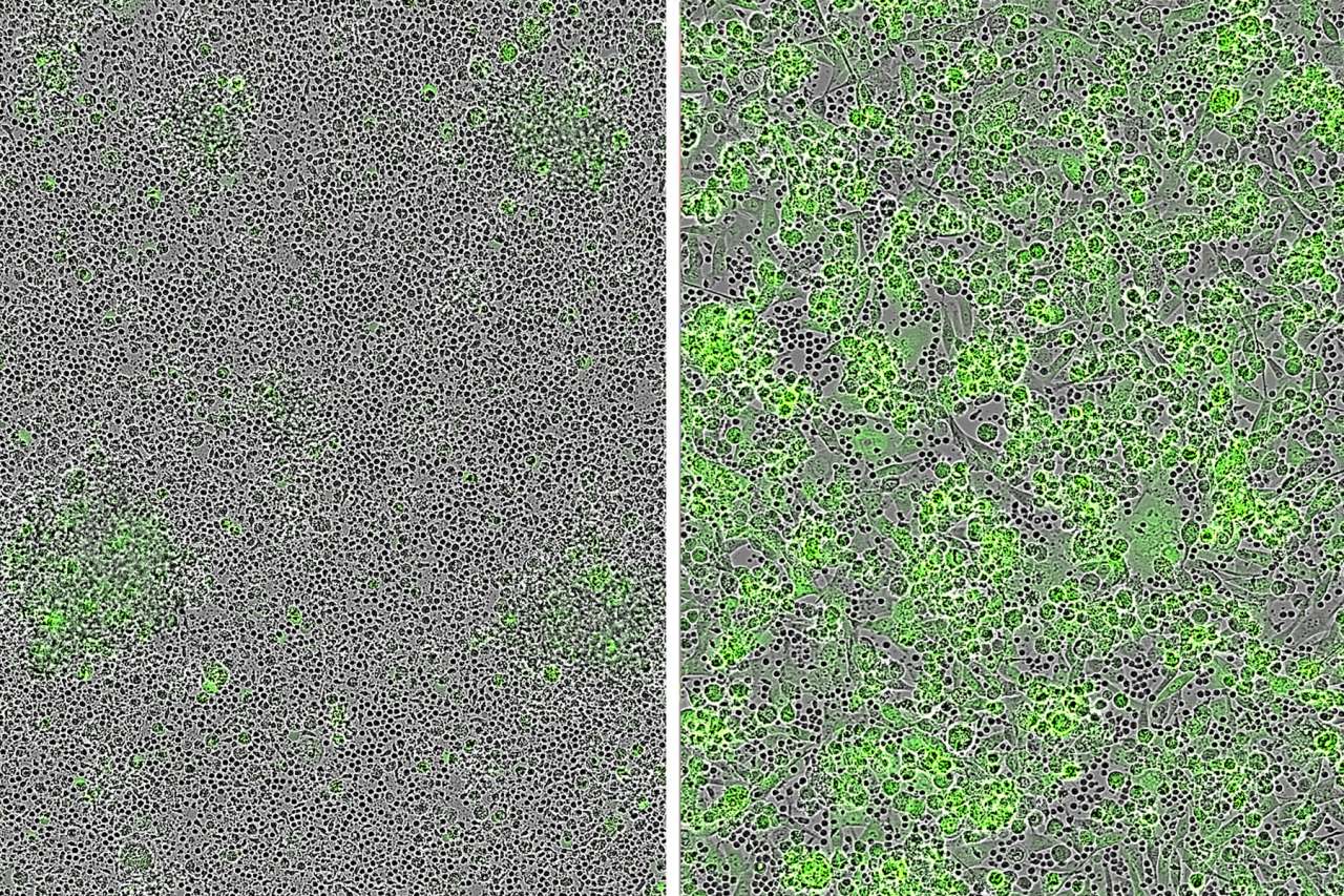 Promising target for CAR T-cell therapy leads to potent antitumor ...