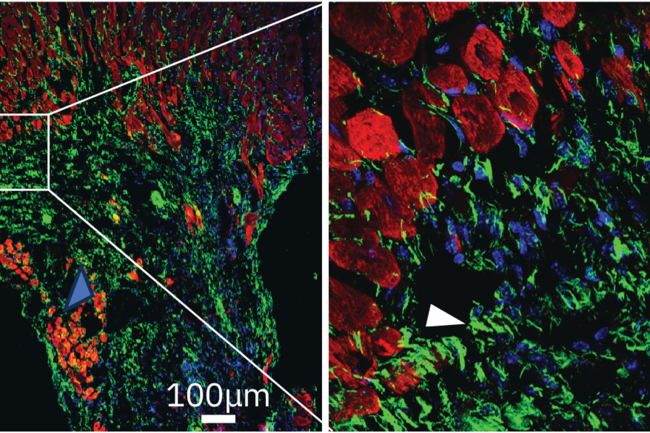 UCLA researchers engineer experimental drug for preventing heart ...