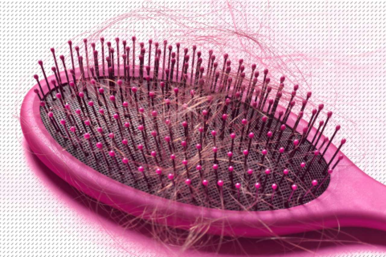 Alopecia areata does not affect actual hair follicle | UCLA Health