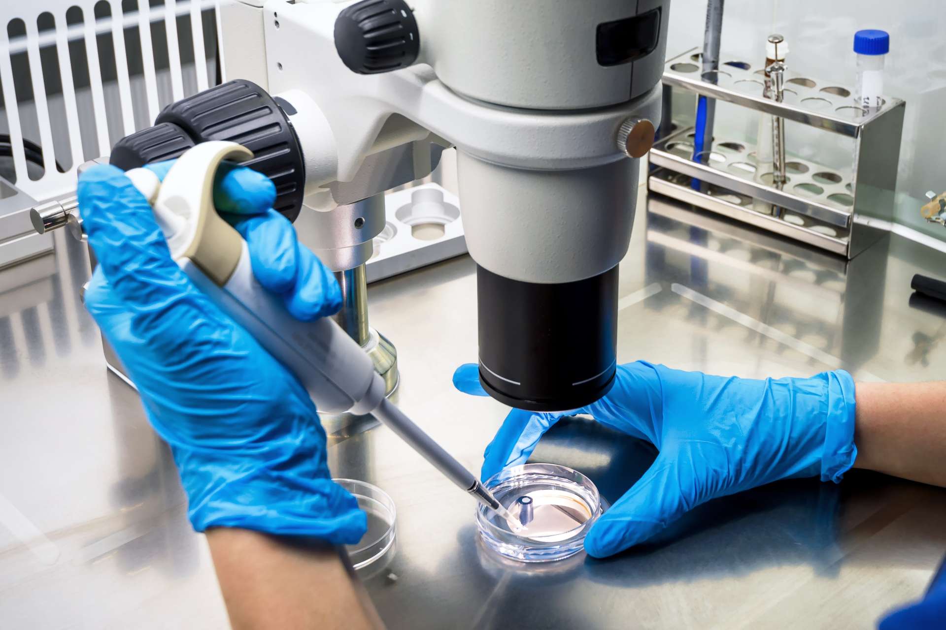 SPORE in Brain Cancer | UCLA Health Jonsson Comprehensive Cancer Center