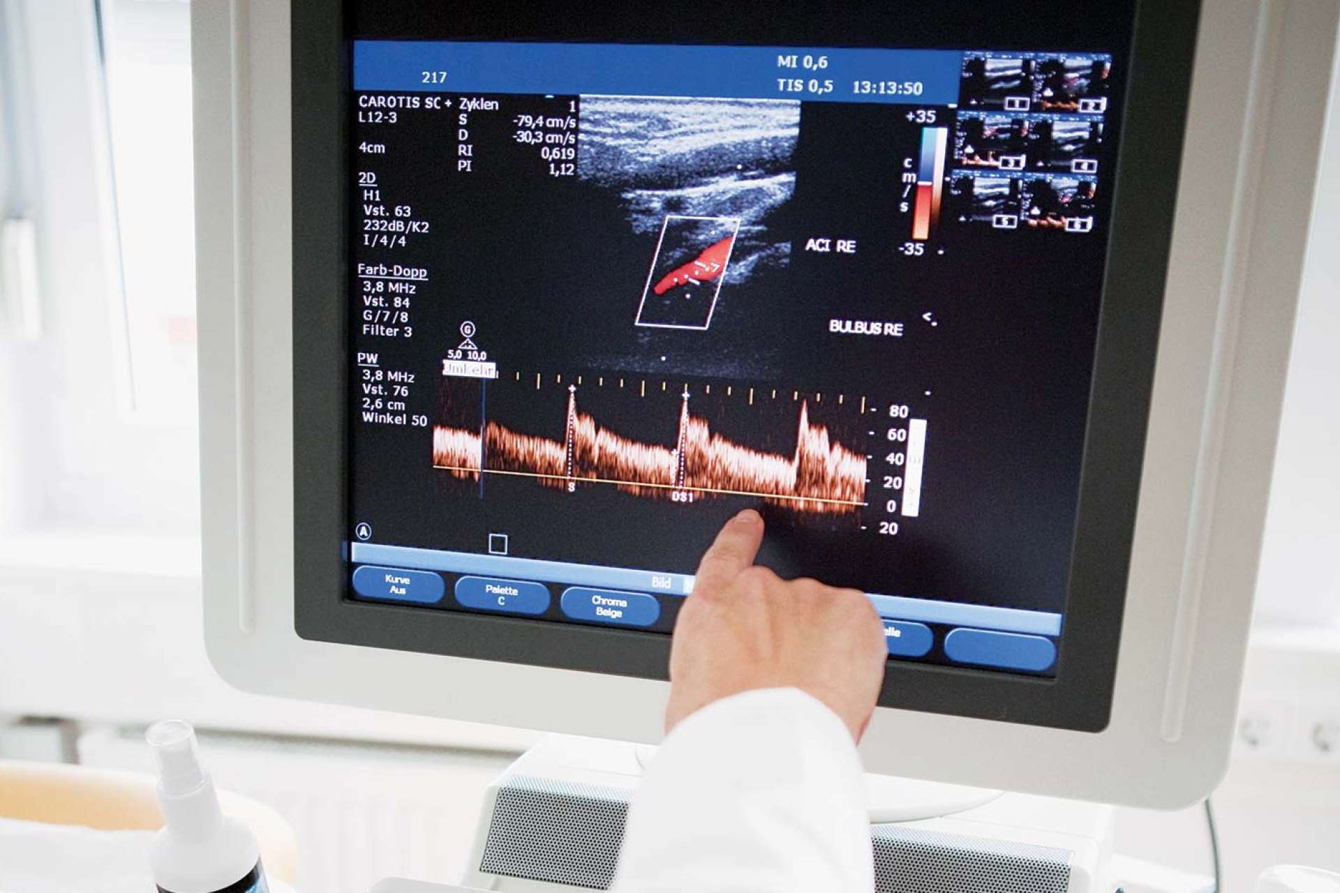 UCLA Division of Cardiology | UCLA Health