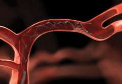 Clinical Updates - Radiology | UCLA Health