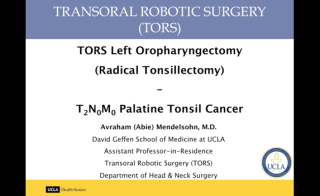 How I Do It - Head & Neck Surgery | UCLA Health