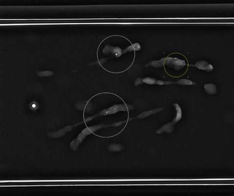 How to Perform: Stereotactic (Mammographic Guided Biopsy) - Radiology ...