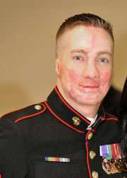 Meet Our Warriors - Operation Mend | UCLA Health