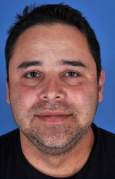 Meet Our Warriors - Operation Mend | UCLA Health